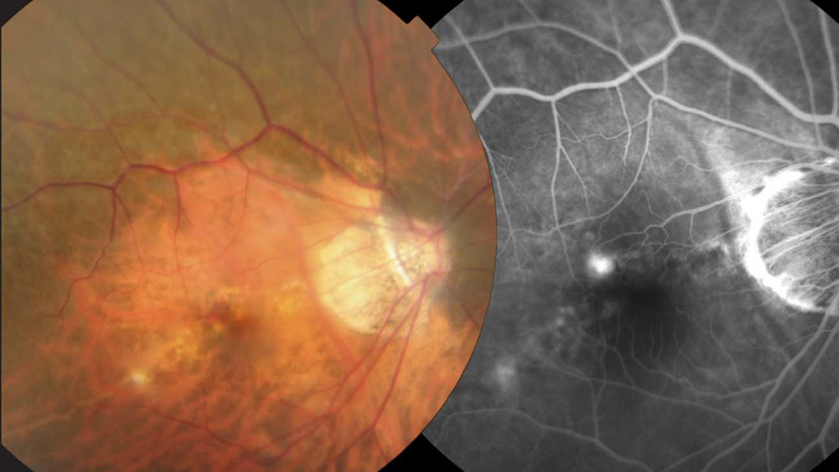 Asian Perspectives on Eye Diseases
