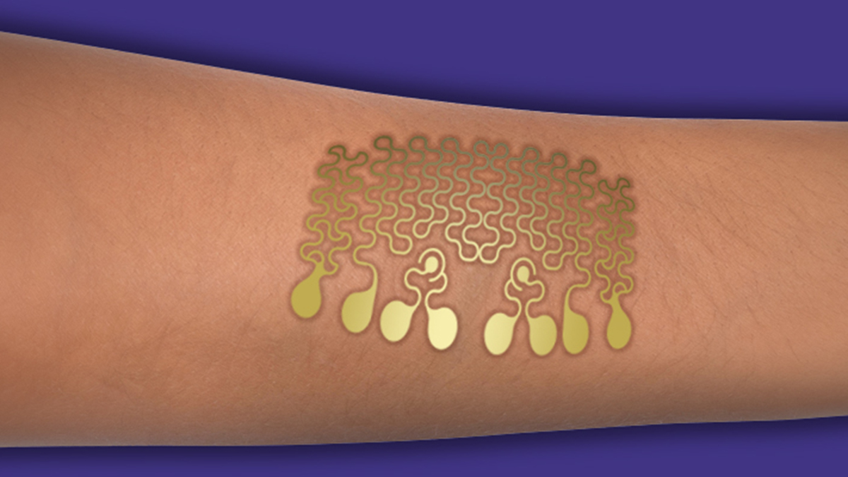 Bioelectronic interfaces