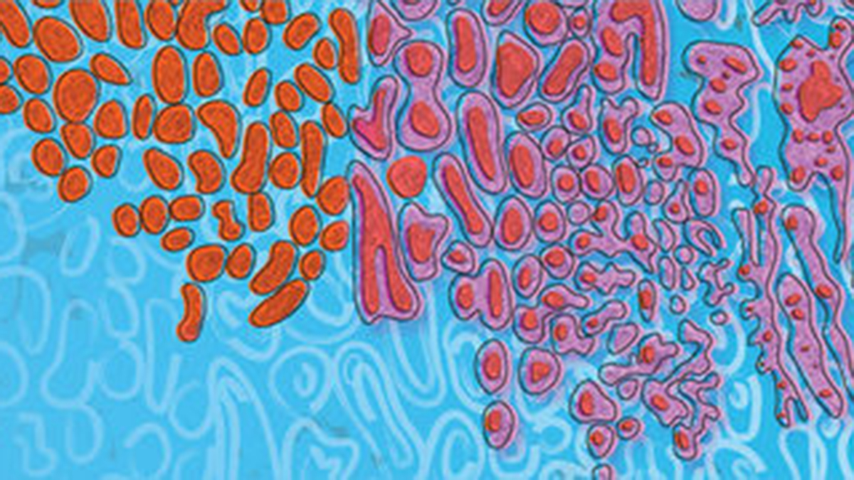 GnRH Analogues and Prostate Cancer