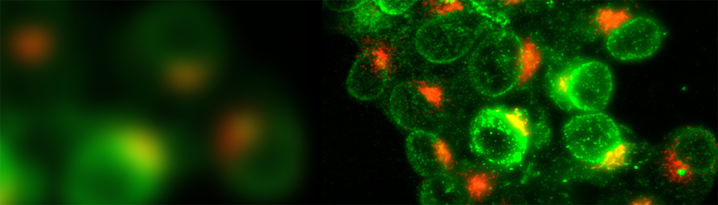 Innate lymphoid cells